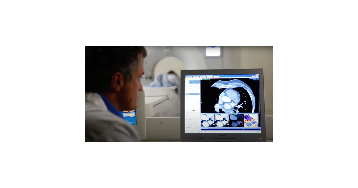 Cardiac imaging with spectral-detector CT - Philips