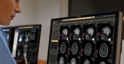 Philips - System IntelliSpace Portal