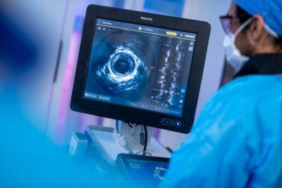 Peripheral IVUS - Philips