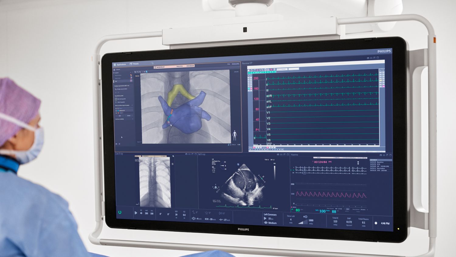 Advancements in electrophysiology: integrating technology over the ...